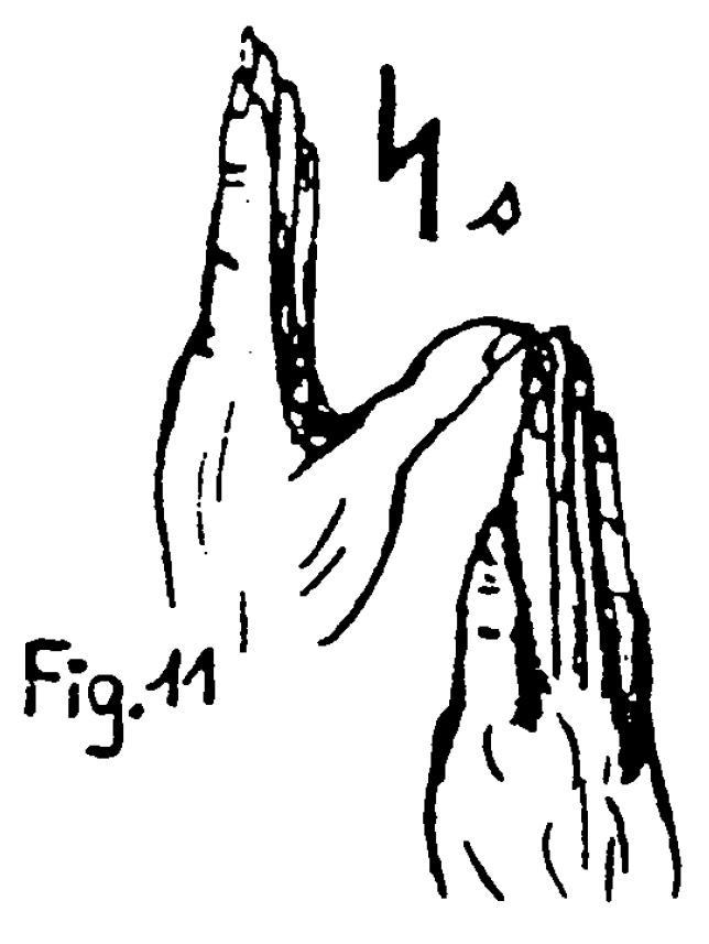 The Sig, Sol, or Sun Rune – Gnostic Studies